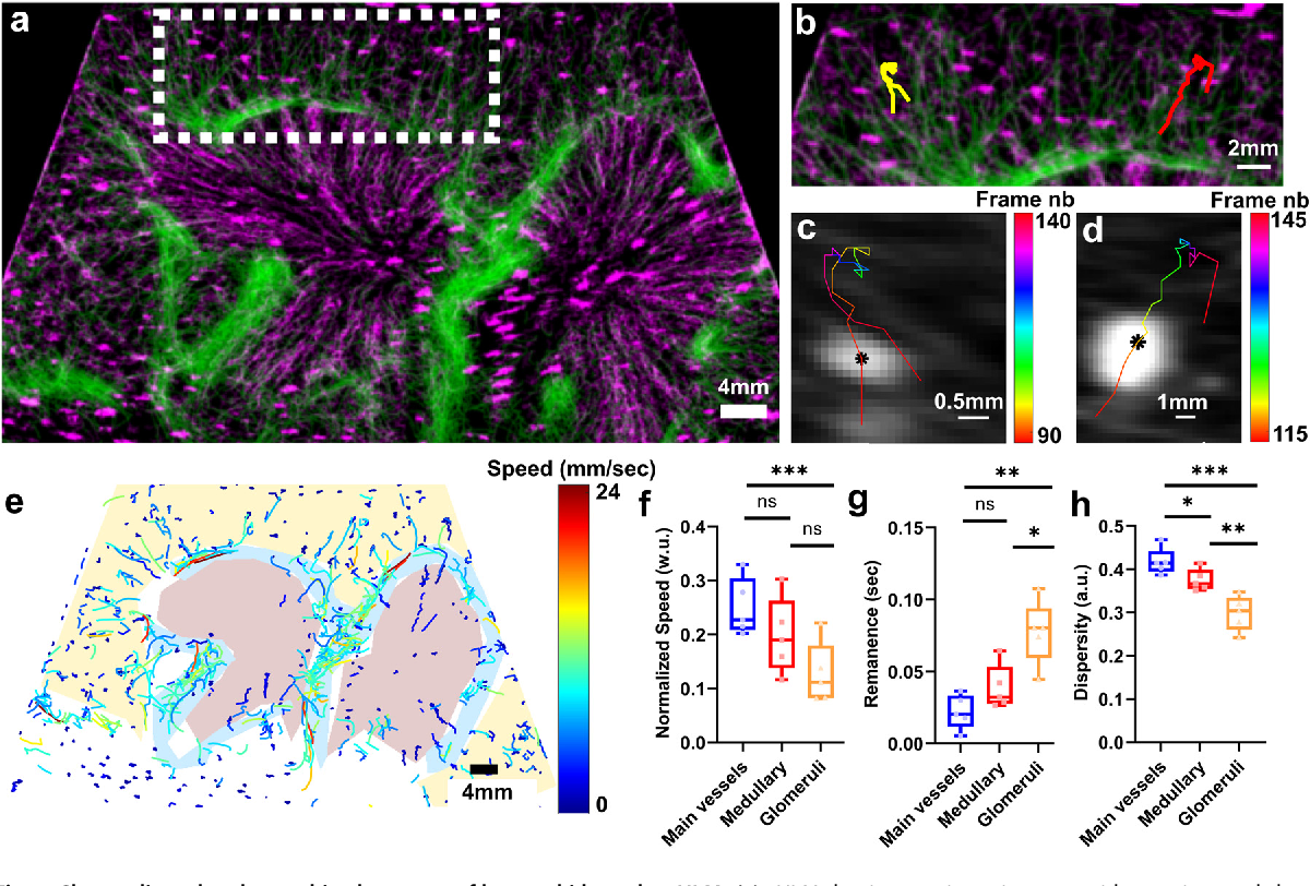 Figure 1 From Sensing Ultrasound Localization Microscopy For The