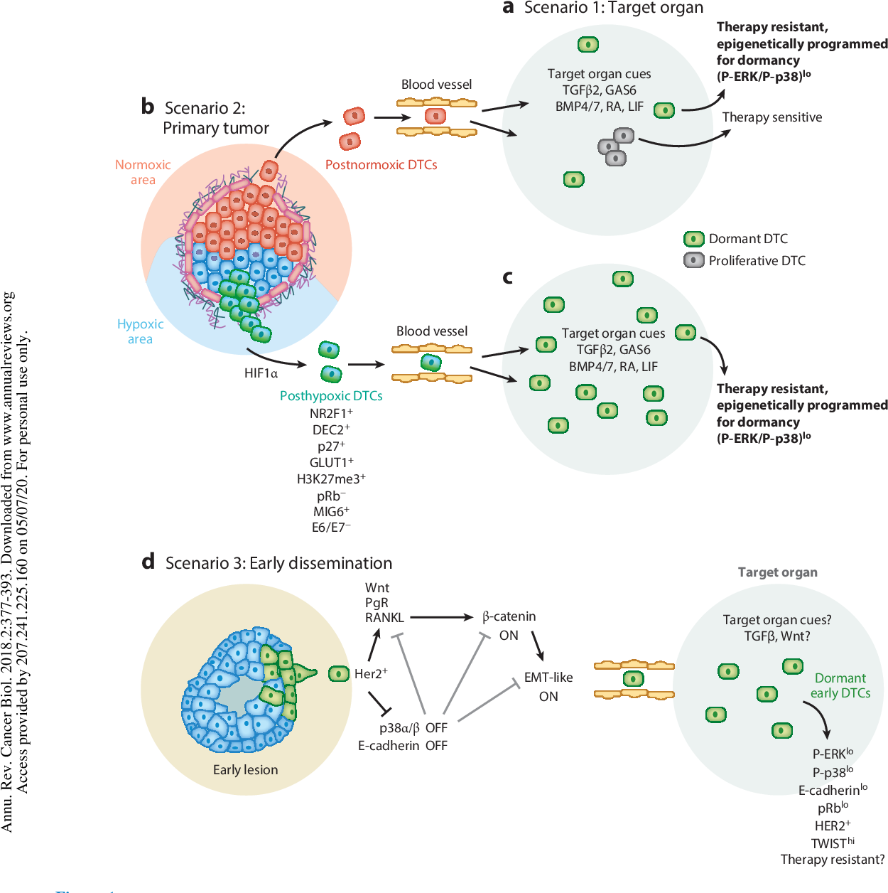 Figure 1 From Emerging Topics On Disseminated Cancer Cell Dormancy And