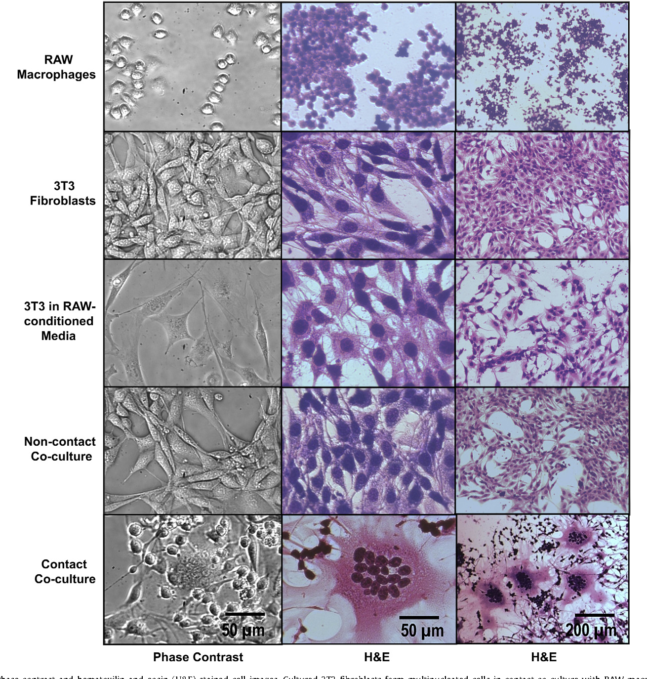 Fibroblasts In Culture