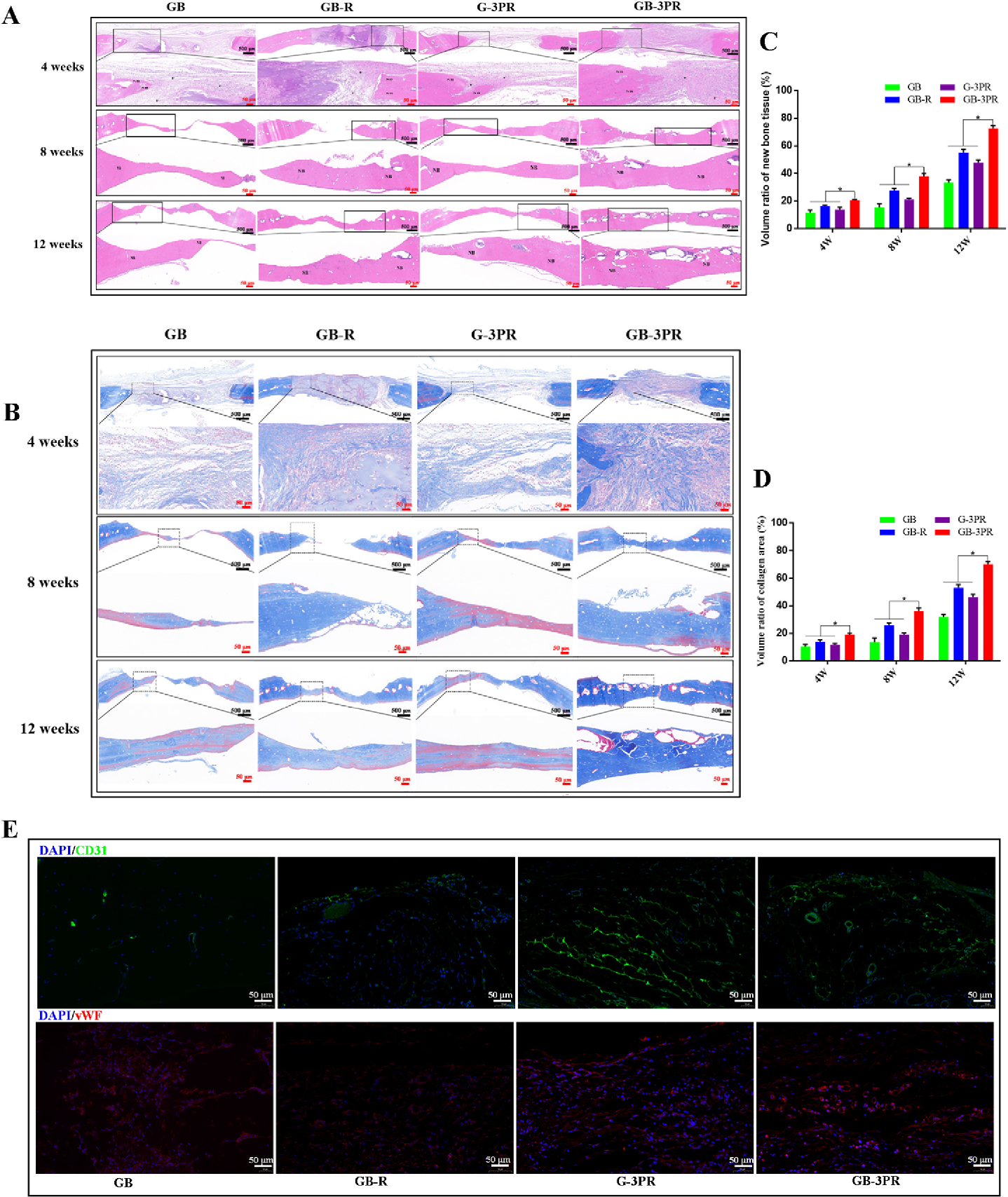 3d Bioprinting Of In Situ Vascularized Tissue Engineered Bone For