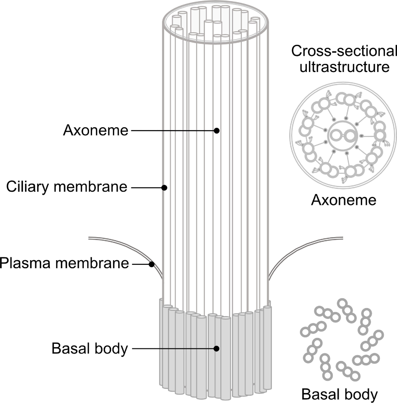 Figure 1 From Understanding Primary Ciliary Dyskinesia And Other