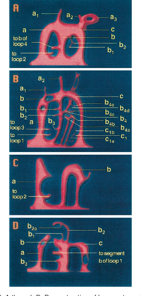 Figure 1 From Vascular Morphogenesis And Remodeling In A Human Tumor