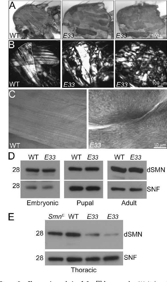 Figure 1 From Smn S Muscular Function Neurons Apoptosis Necrosis