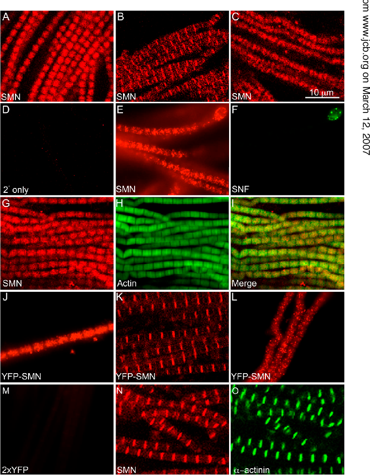 Figure 1 From Smn S Muscular Function Neurons Apoptosis Necrosis