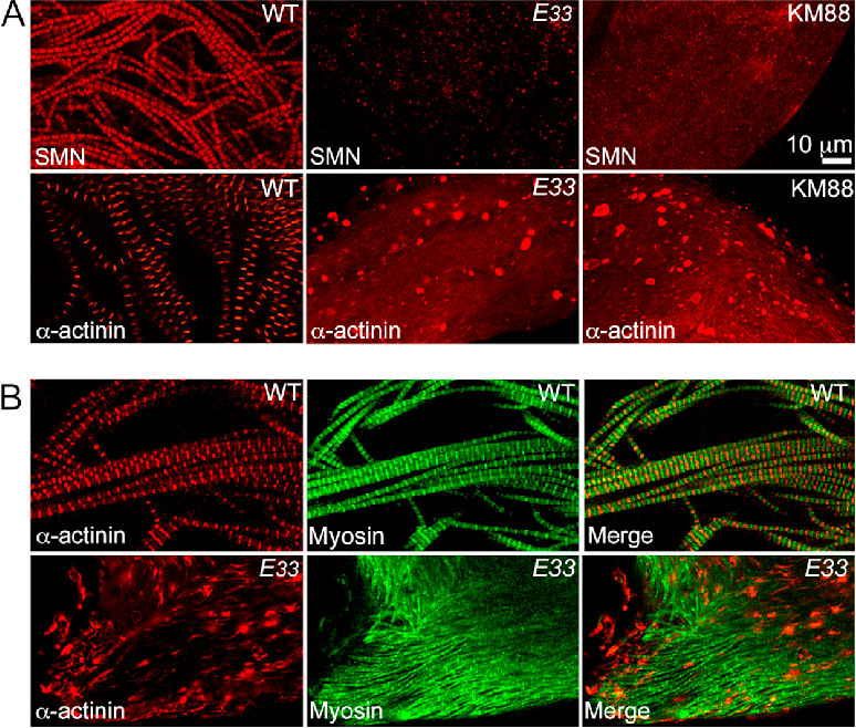 Figure 1 From Smn S Muscular Function Neurons Apoptosis Necrosis