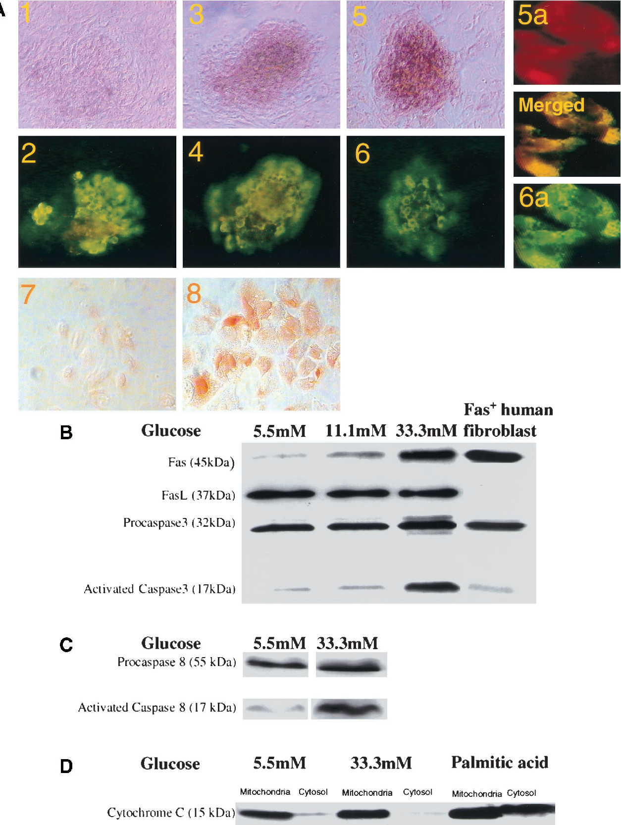 Pdf Glucose Induces Beta Cell Apoptosis Via Upregulation Of The Fas