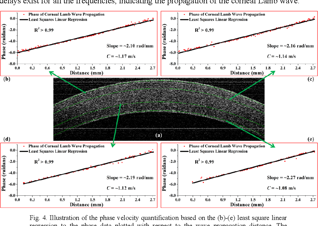 Figure 4 From Noncontact Depth Resolved Micro Scale Optical Coherence