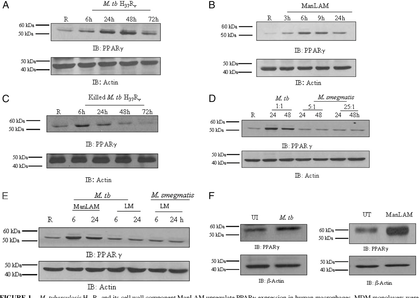 Immunologymicrobiology Glossary Tuberculosis Pathogen