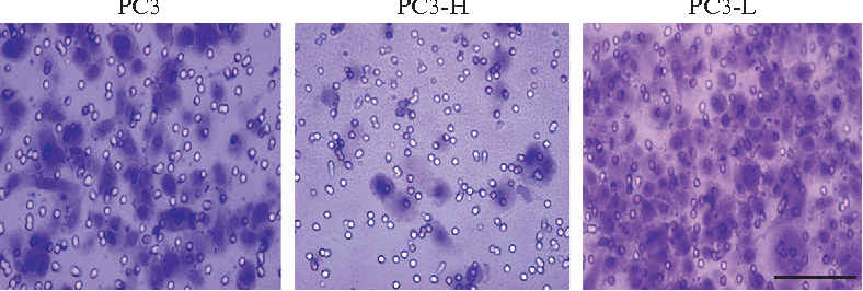 Figure 221 From A Tumor Suppressor Function Of Laminin Binding Alpha