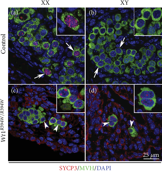 Pdf Abnormal Meiosis Initiation In Germ Cell Caused By Aberrant