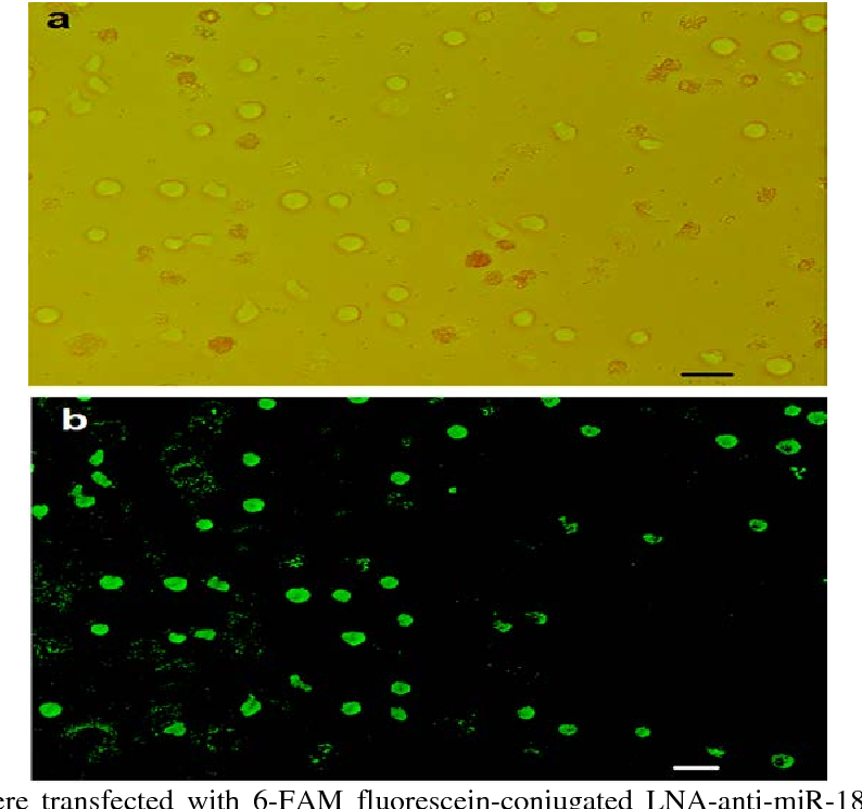 Figure 1 From Apoptosis Induction In Acute Promyelocytic Leukemia Cells