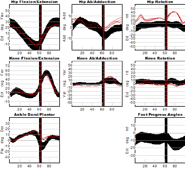 Pdf Kinematic And Kinetic Gait Analysis Of Bilateral Knee