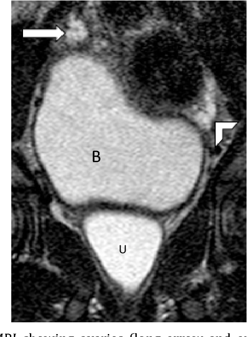 Figure 1 From Role Of Magnetic Resonance Imaging In Assigning Sex In An