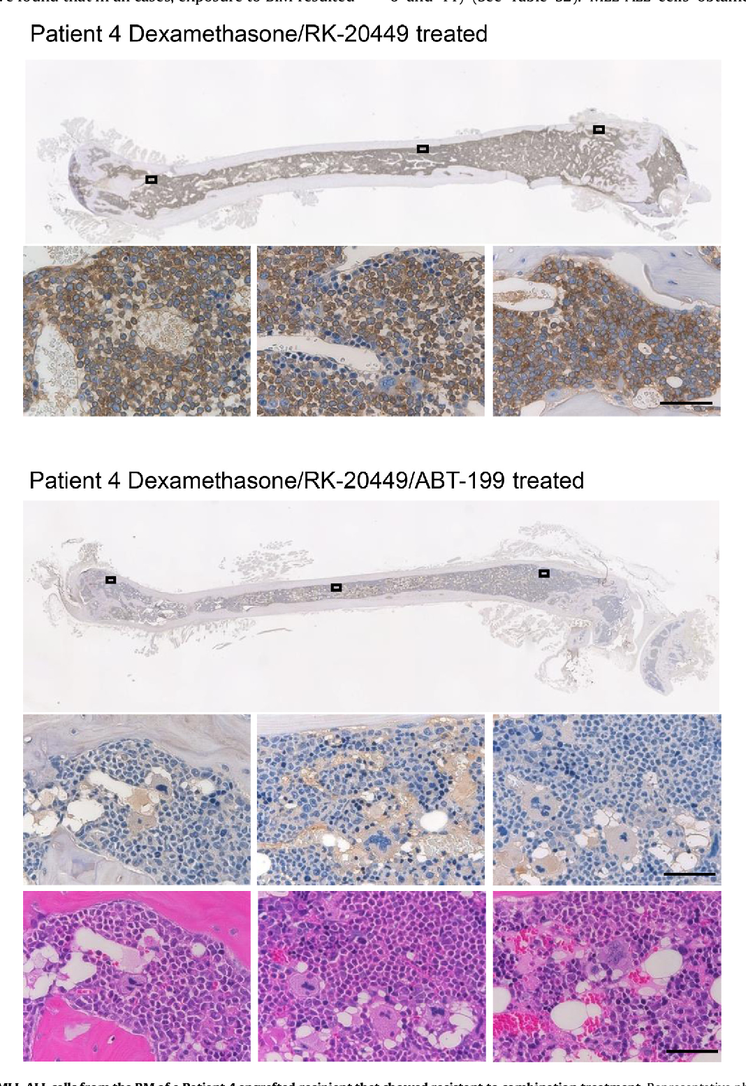 Figure 1 From Targeting Critical Kinases And Anti Apoptotic Molecules