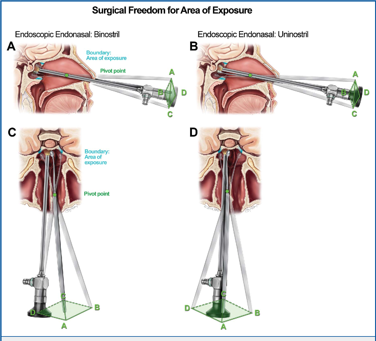 Figure 2 From Evaluation Of Surgical Freedom For Microscopic And