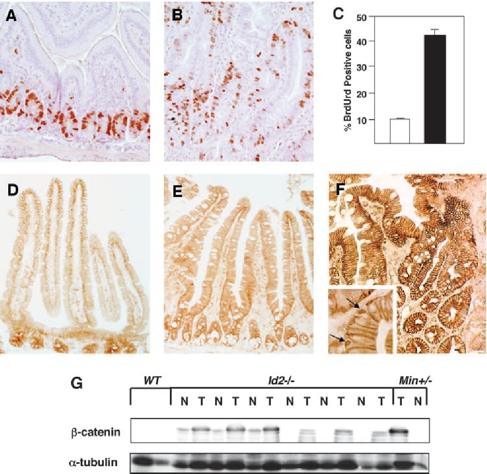 Figure 1 From Id2 Drives Differentiation And Suppresses Tumor Formation