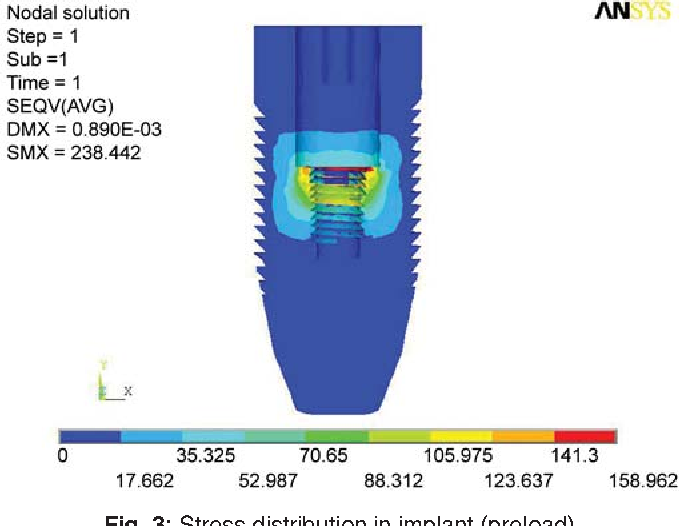 Figure 1 From Influence Of Occlusal Forces On Stress Distribution On