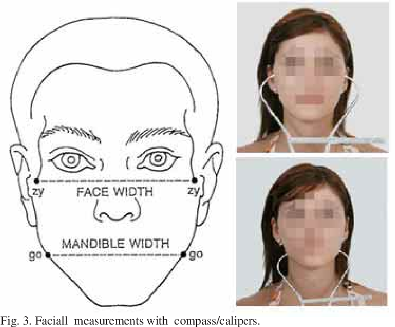 Pdf Bizygomatic Width And Its Association With Social And Personality