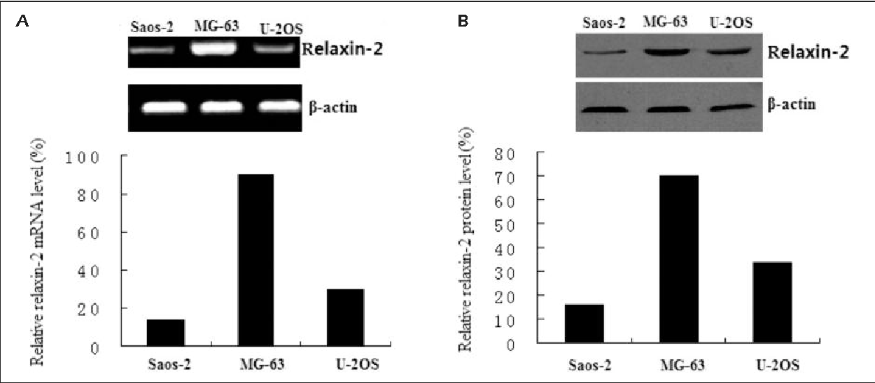 Figure 1 From Rnai Mediated Knockdown Of Relaxin Decreases In Vitro