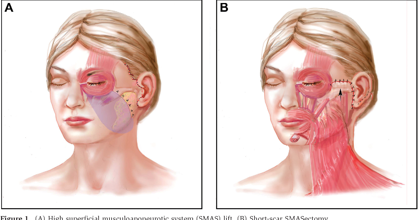 Lymphatic Drainage Face