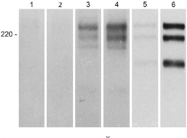 Figure 1 From Laminin Production And Basement Membrane Deposition By