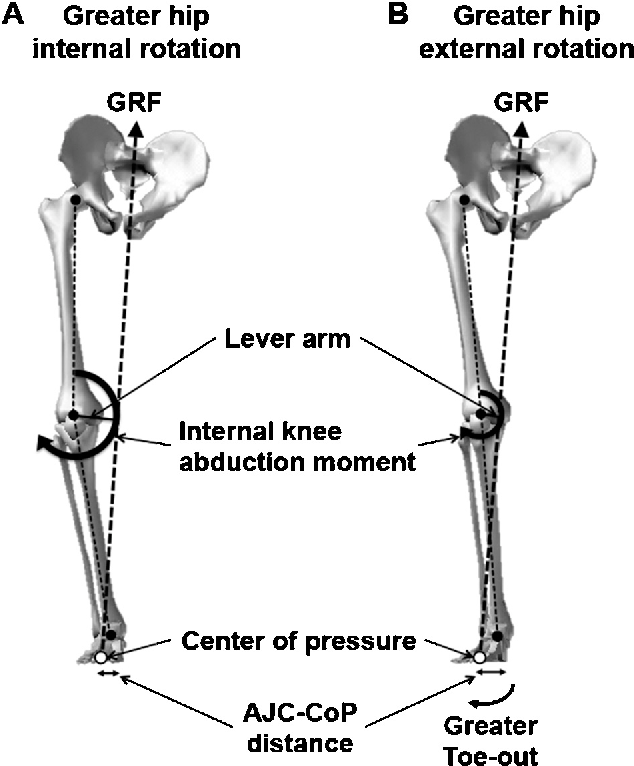 Hip Rotation Angle Is Associated With Frontal Plane Knee Joint