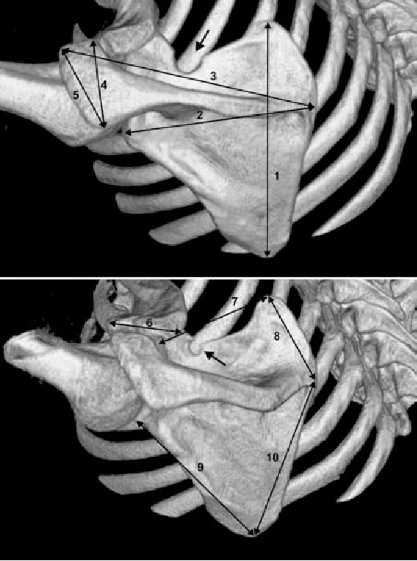 Figure 1 From A Computed Tomography Study On The Correlation Between