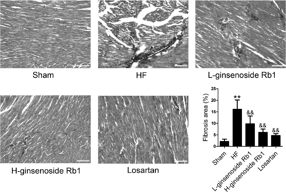 Figure 1 From Ginsenoside Rb1 Improves Cardiac Function And Remodeling