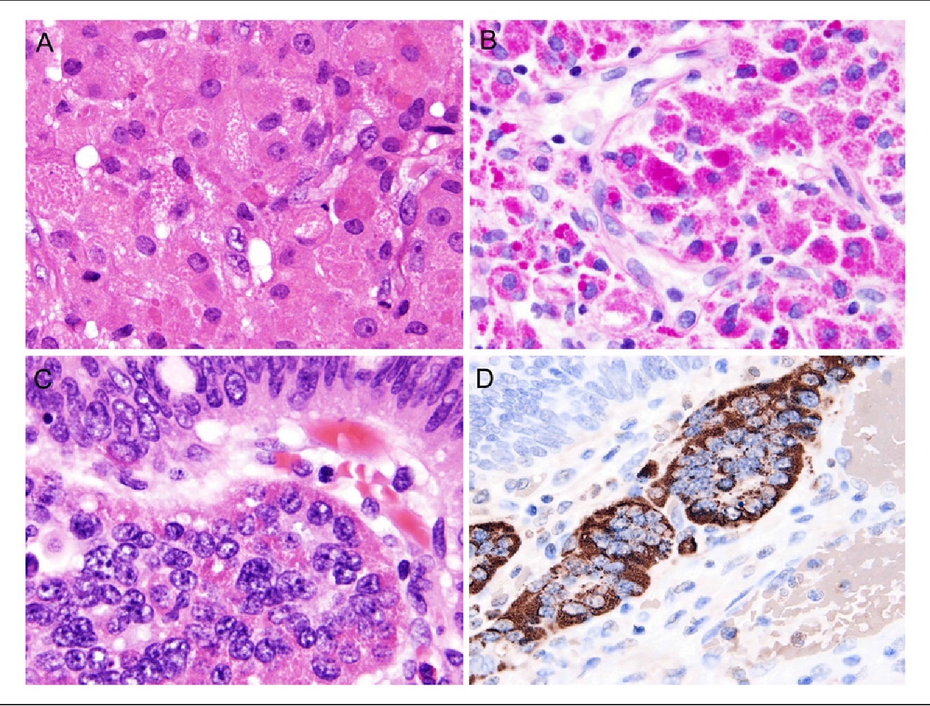 The Wonderful Colors Of The Hematoxylineosin Stain In Diagnostic