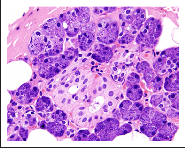 The Wonderful Colors Of The Hematoxylineosin Stain In Diagnostic