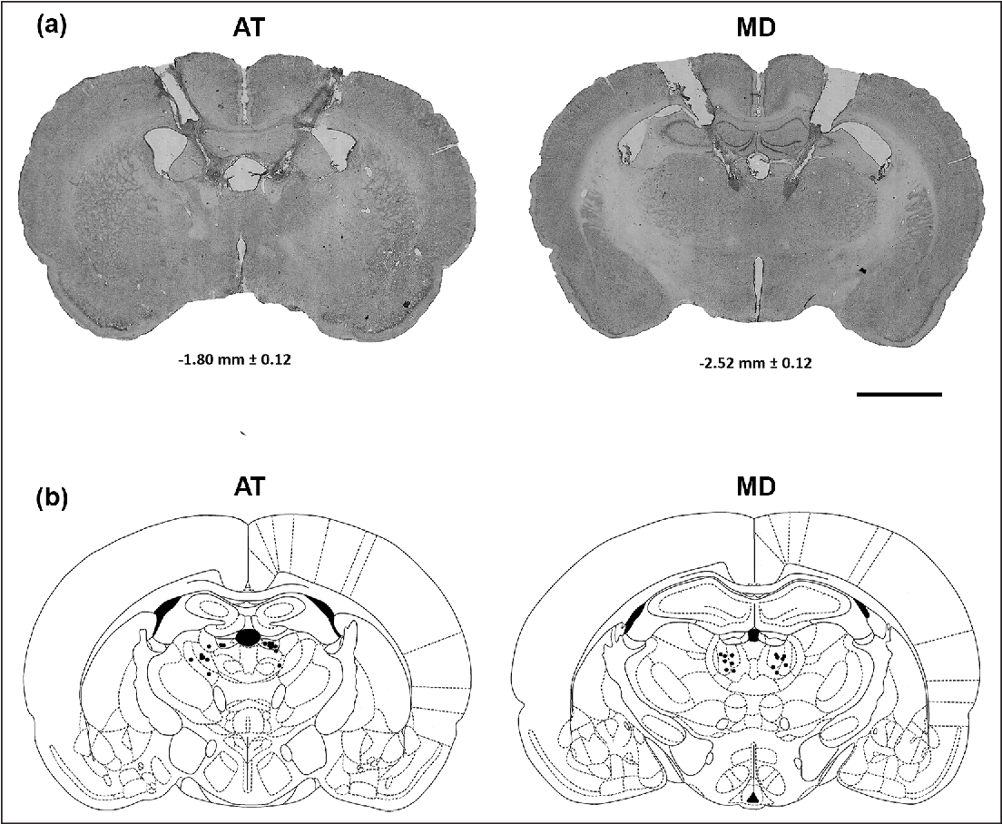 Figure 1 From Dissociable Contributions Of Mediodorsal And Anterior