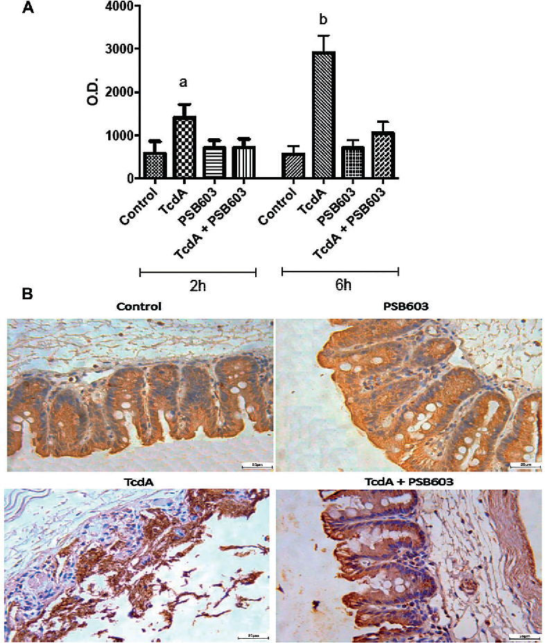 Figure 1 From Clostridium Difficile Toxins Or Infection Induce