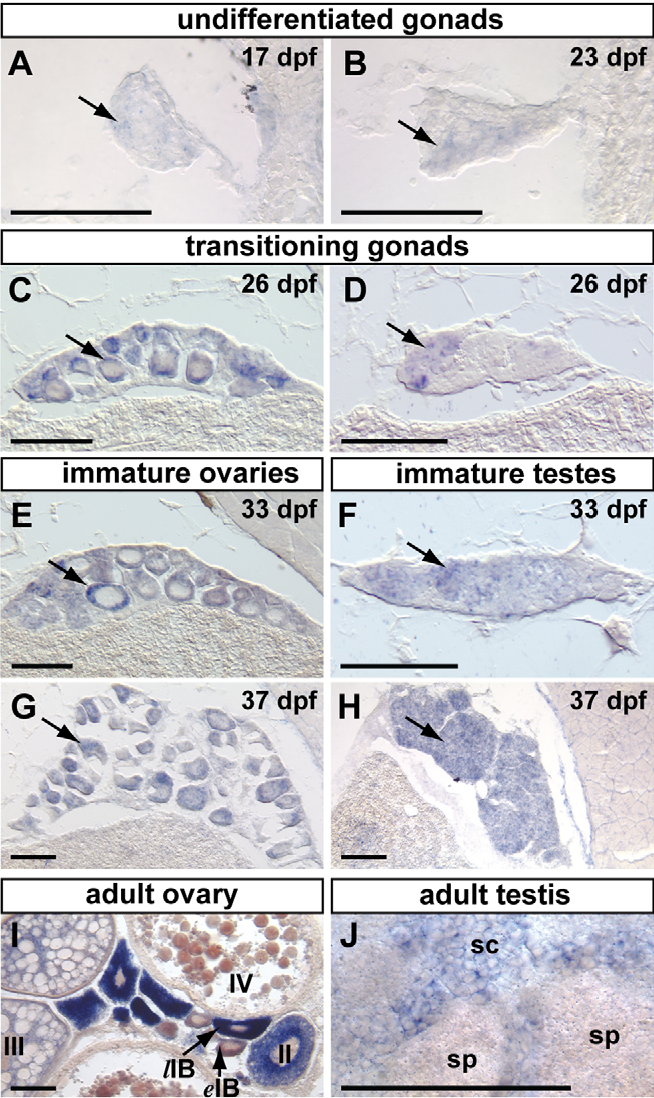 Pdf Sex Reversal In Zebrafish Fancl Mutants Is Caused By Tp53