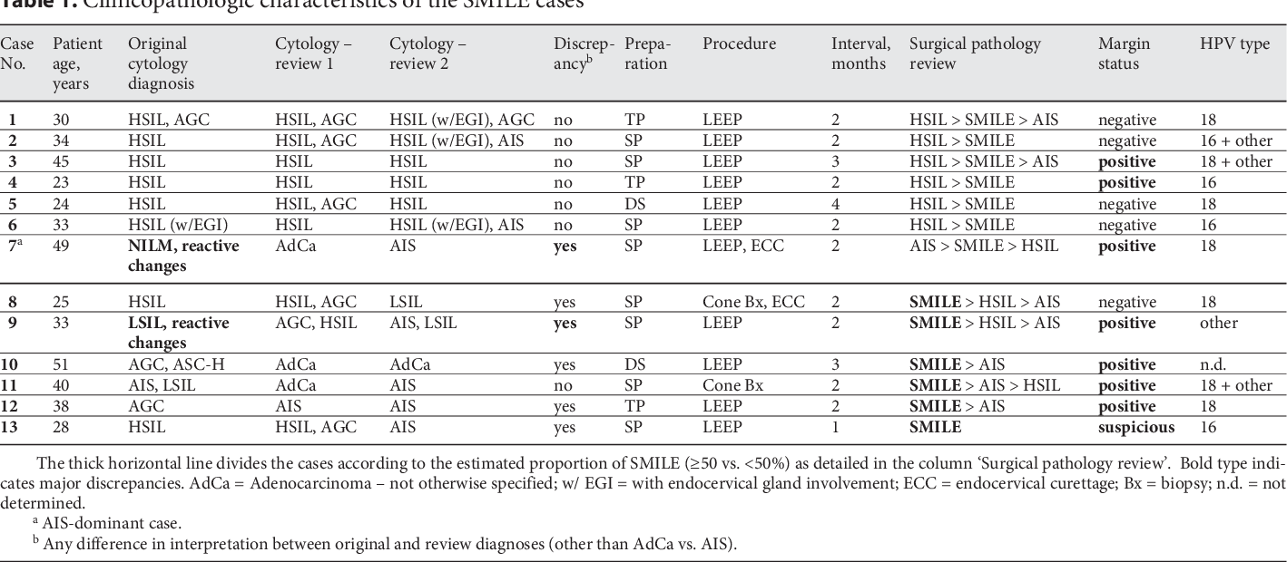 Stratified Mucin Producing Intraepithelial Lesion Of The Cervix Subtle