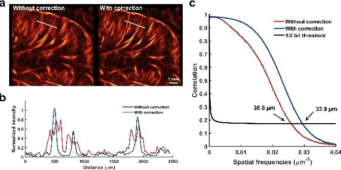 Pdf Towards Transcranial 3d Ultrasound Localization Microscopy Of The