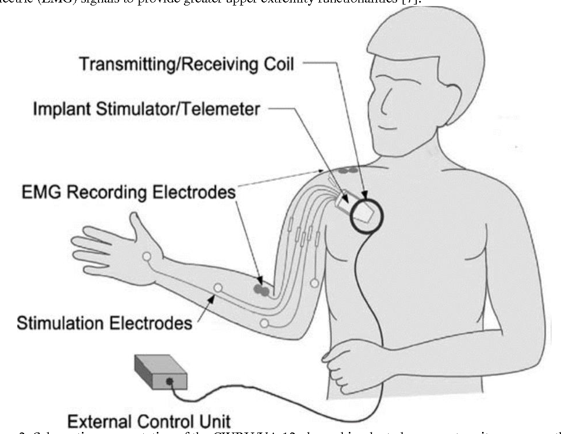 Functional Electrical Stimulation Fes Review Semantic Scholar