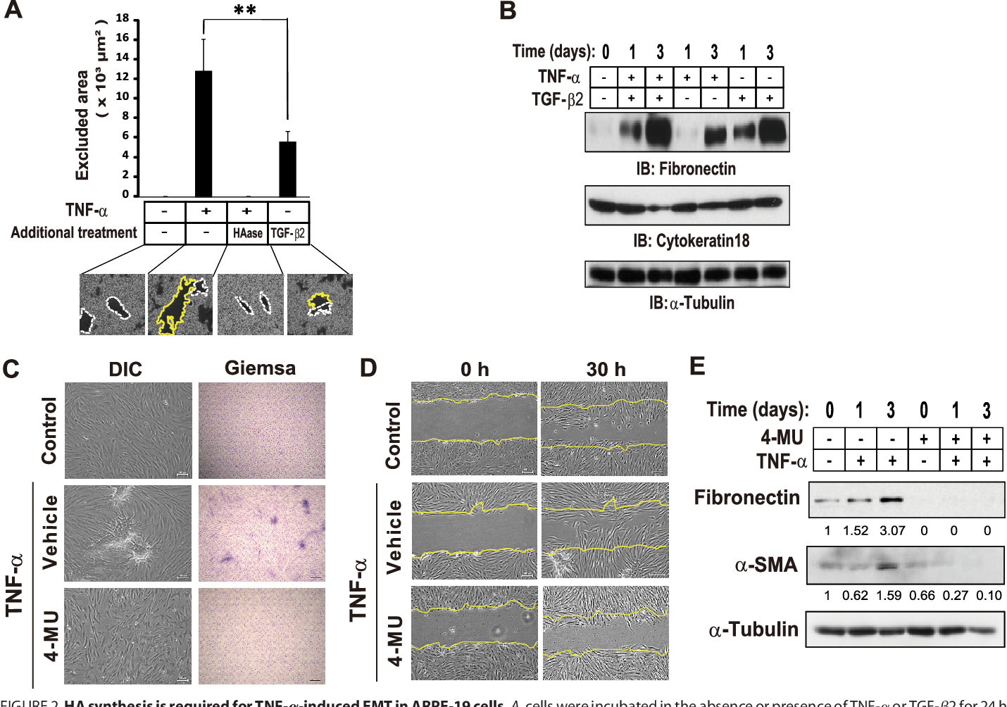 Figure 1 From Tumor Necrosis Factor α Regulates Transforming Growth