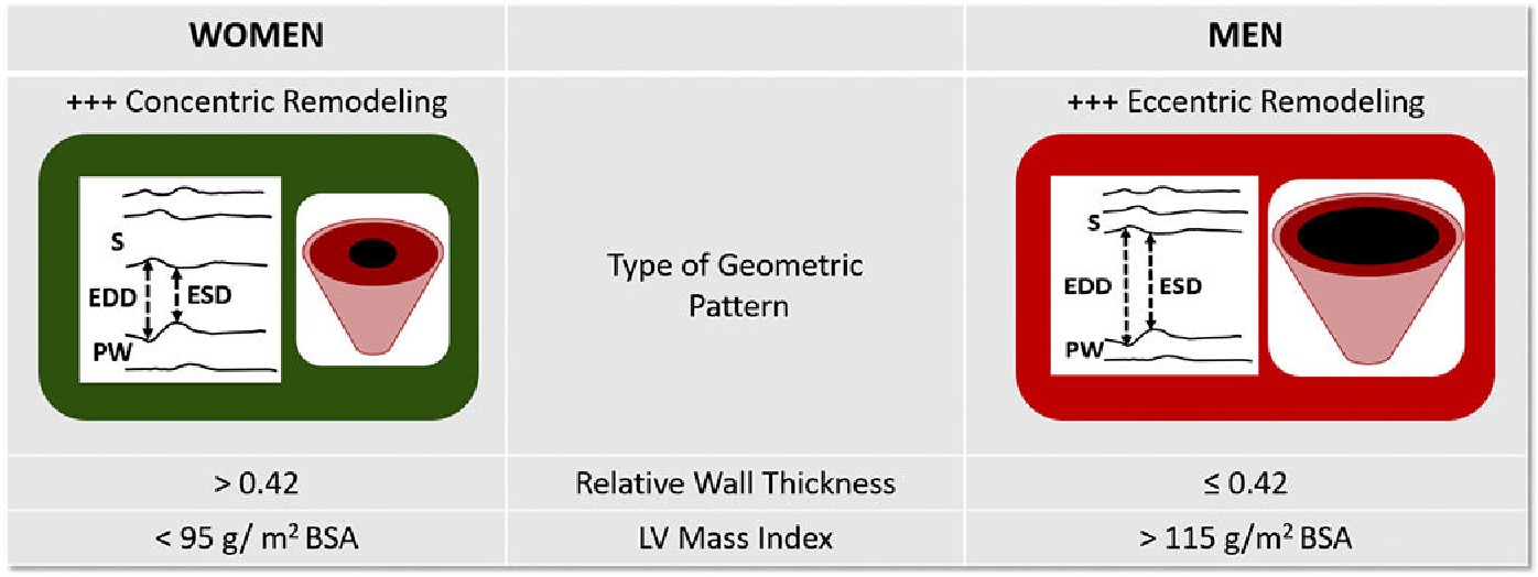 Sex Differences In Aortic Stenosis Identification Of Knowledge Gaps