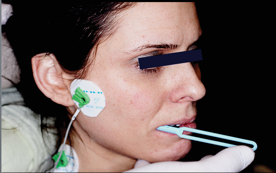 Figure 1 From Transcutaneous Electrical Nerve Stimulation Tens