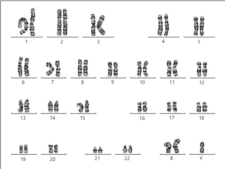 Figure 1 From Efficiency Of Noninvasive Prenatal Testing For Sex