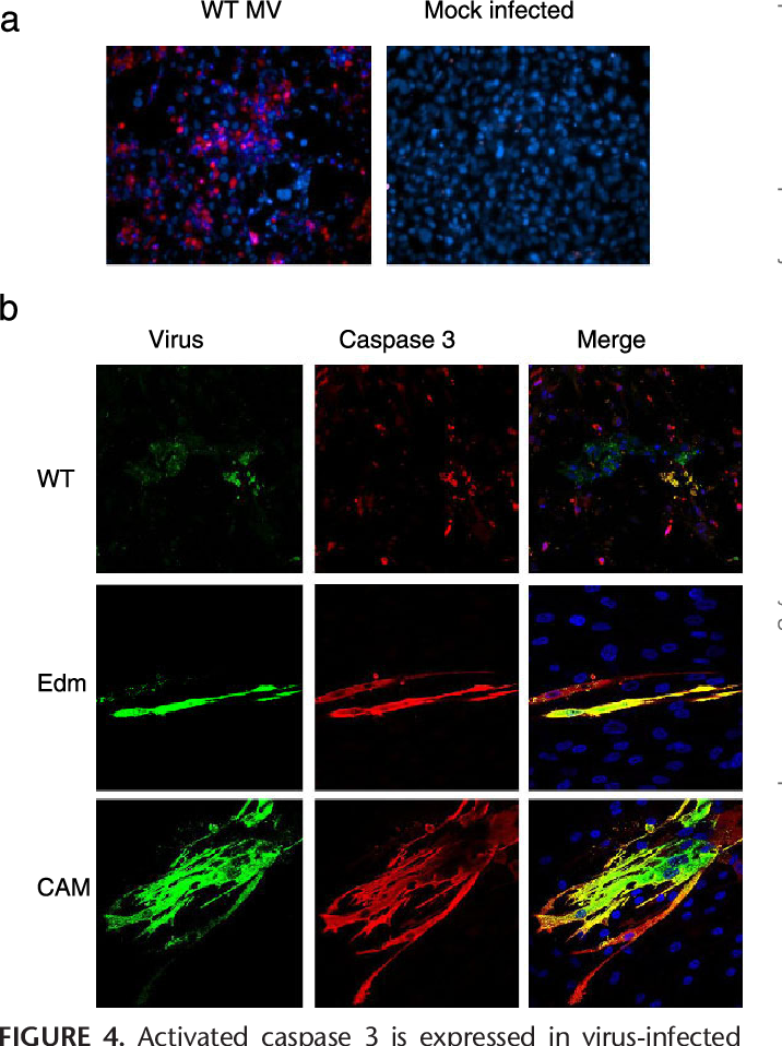 Figure 1 From Article Navigation Wild Type Measles Virus Infection