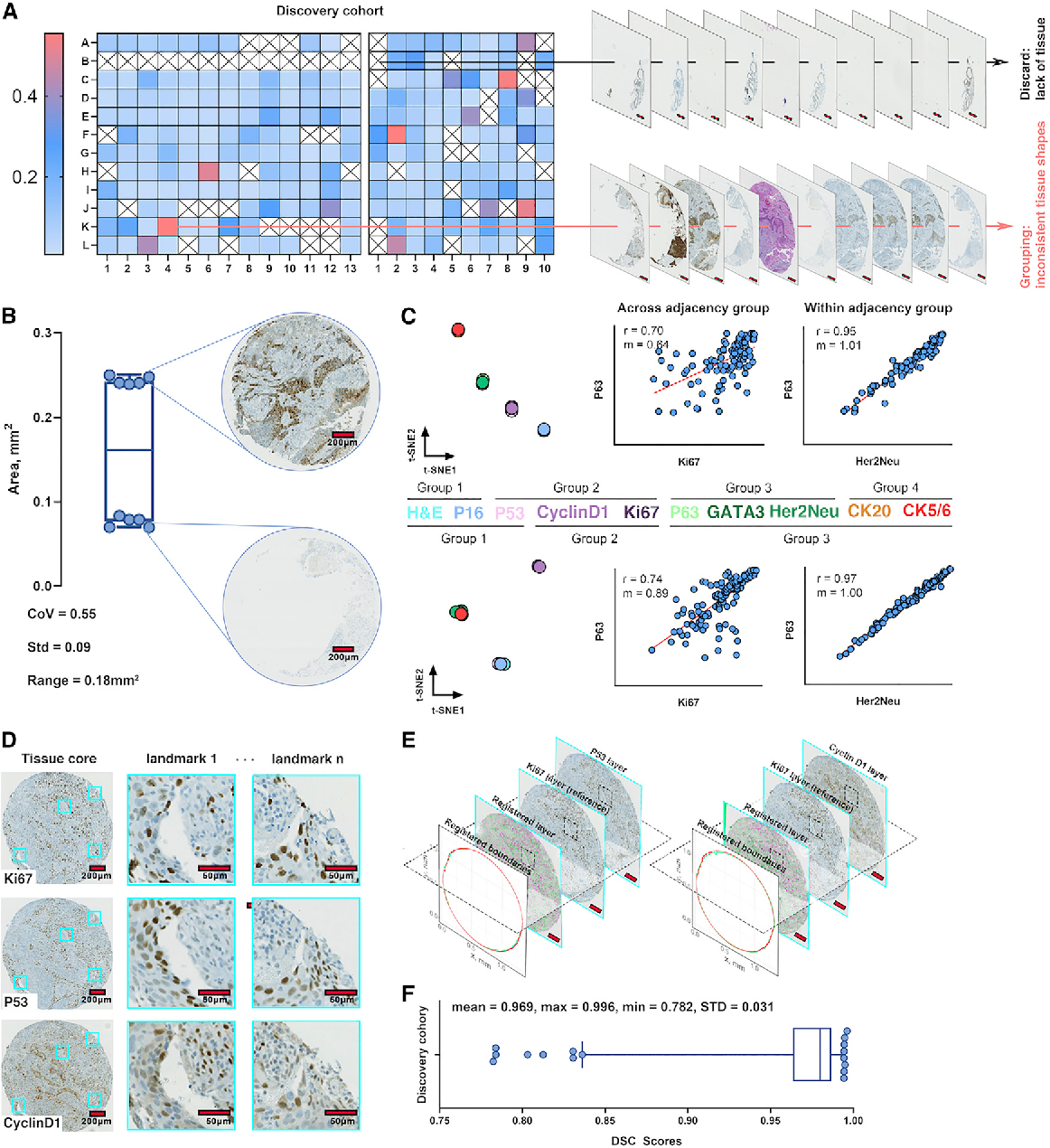 Figure 3 From Predictive Models Of Response To Neoadjuvant Chemotherapy