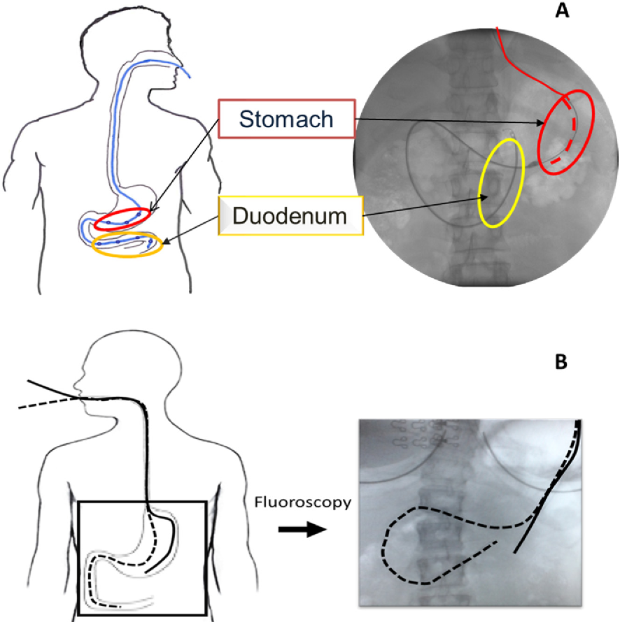 Figure 1 From Impact Of Regional Differences Along The Gastrointestinal