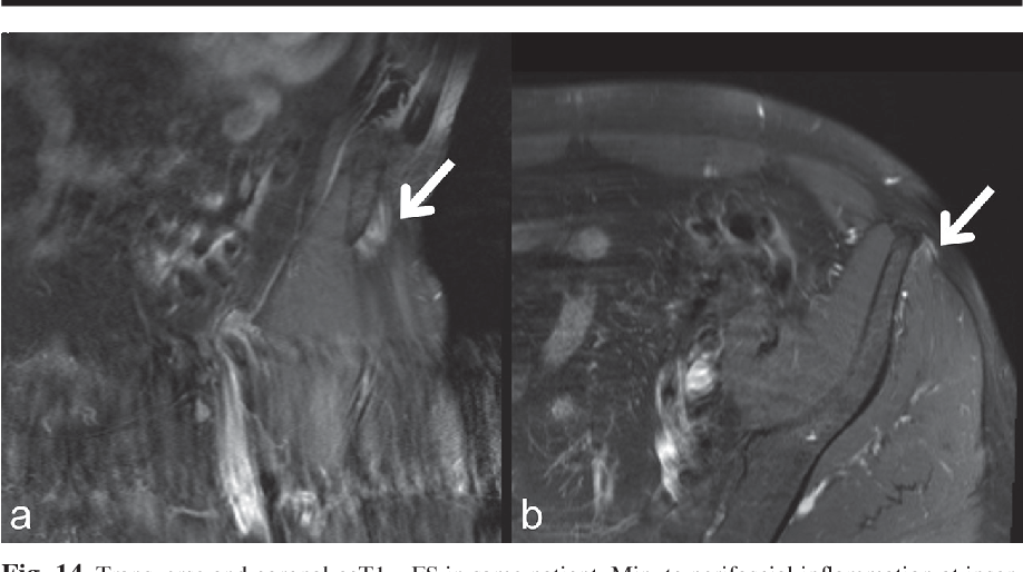 Figure 1 From Use Of Contrast Enhanced Magnetic Resonance Imaging Of