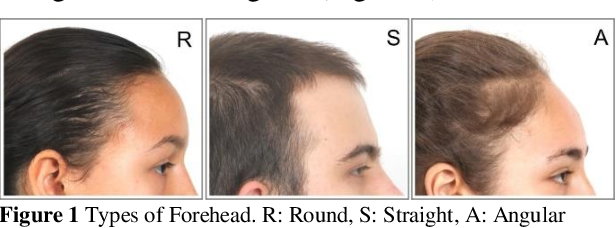 Pdf Relationship Of Forehead Aesthetics With Frontal Sinus Size And