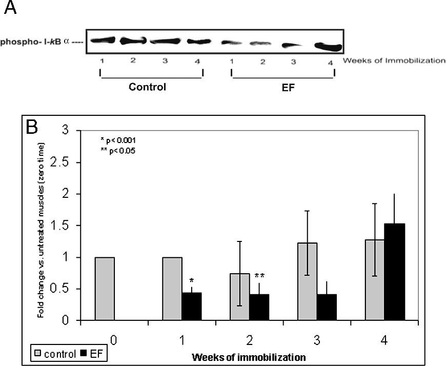 The Role Of Nf Kappab In Protein Breakdown In Immobilization Aging