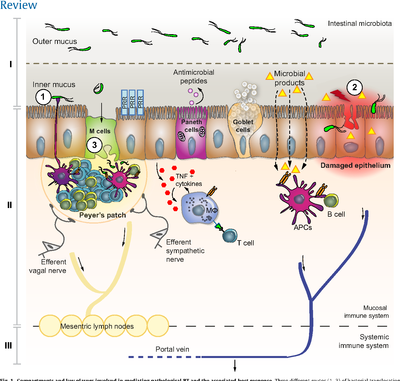 Figure 1 From Pathological Bacterial Translocation In Liver Cirrhosis