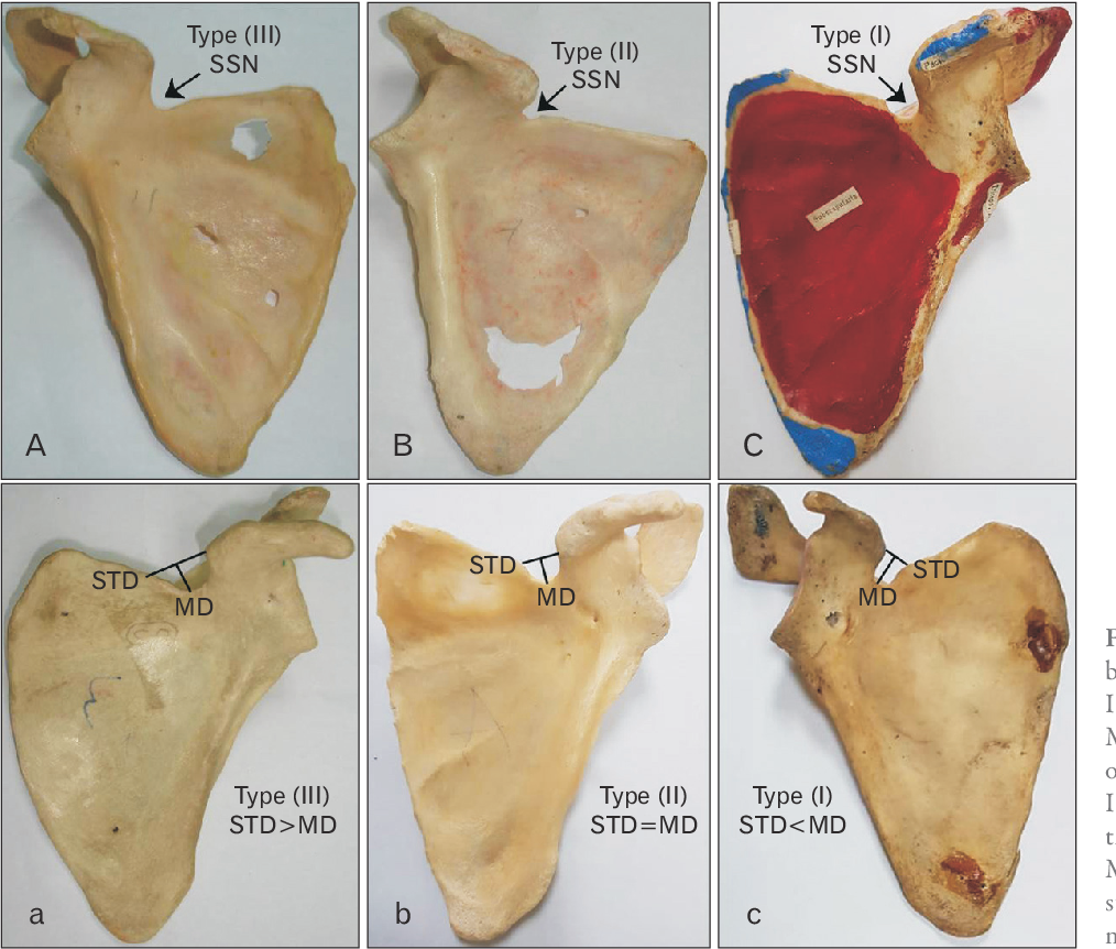 Figure 1 From Morphological Types And Morphometrical Measurements Of