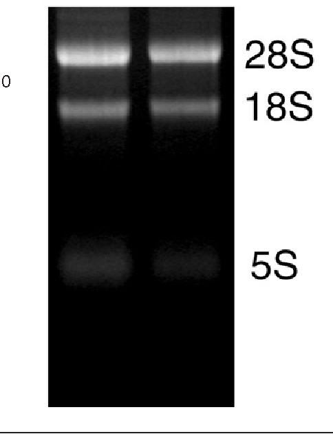 Table 1 From The Single Step Method Of Rna Isolation By Acid