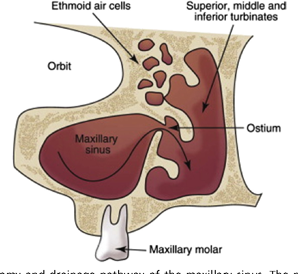 Figure 4 From Maxillary Sinus Augmentation Semantic Scholar